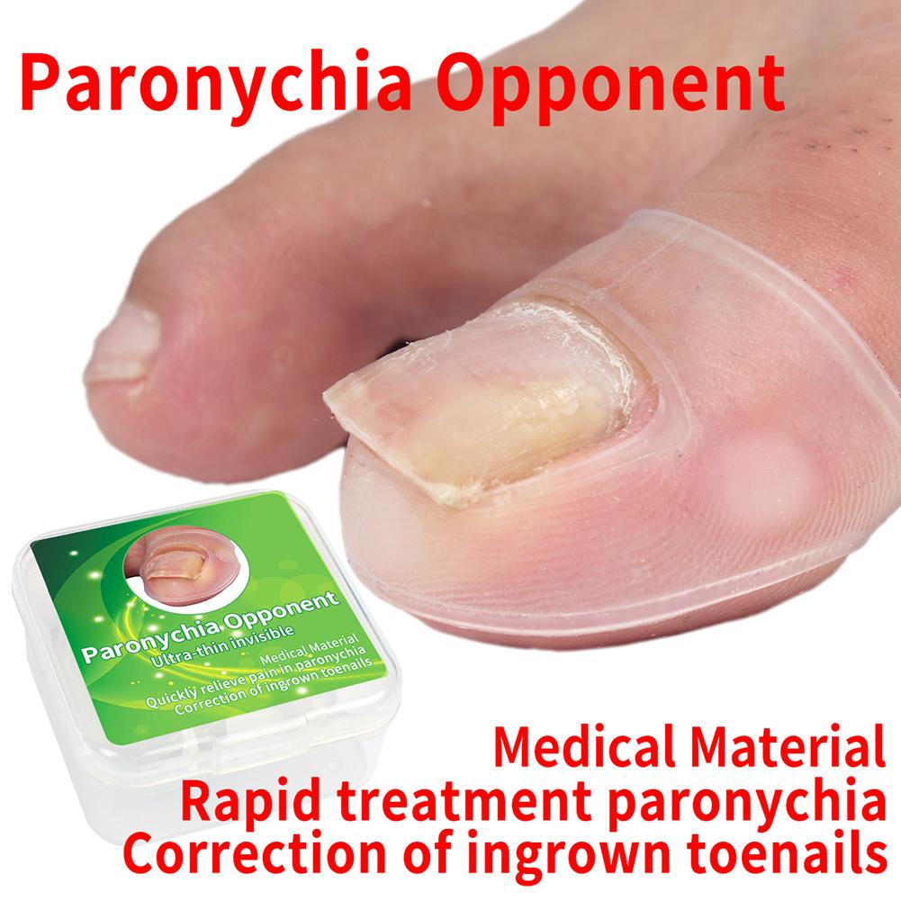 Ingrown Toenail Correction Silicon Cover - 4 Pack – BetterToes